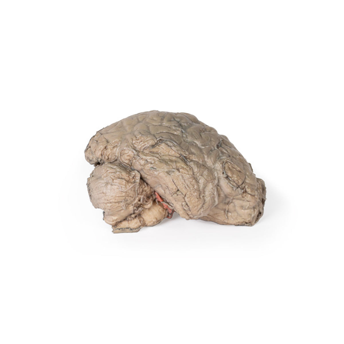 Brain Hemisection – Sim & Skills