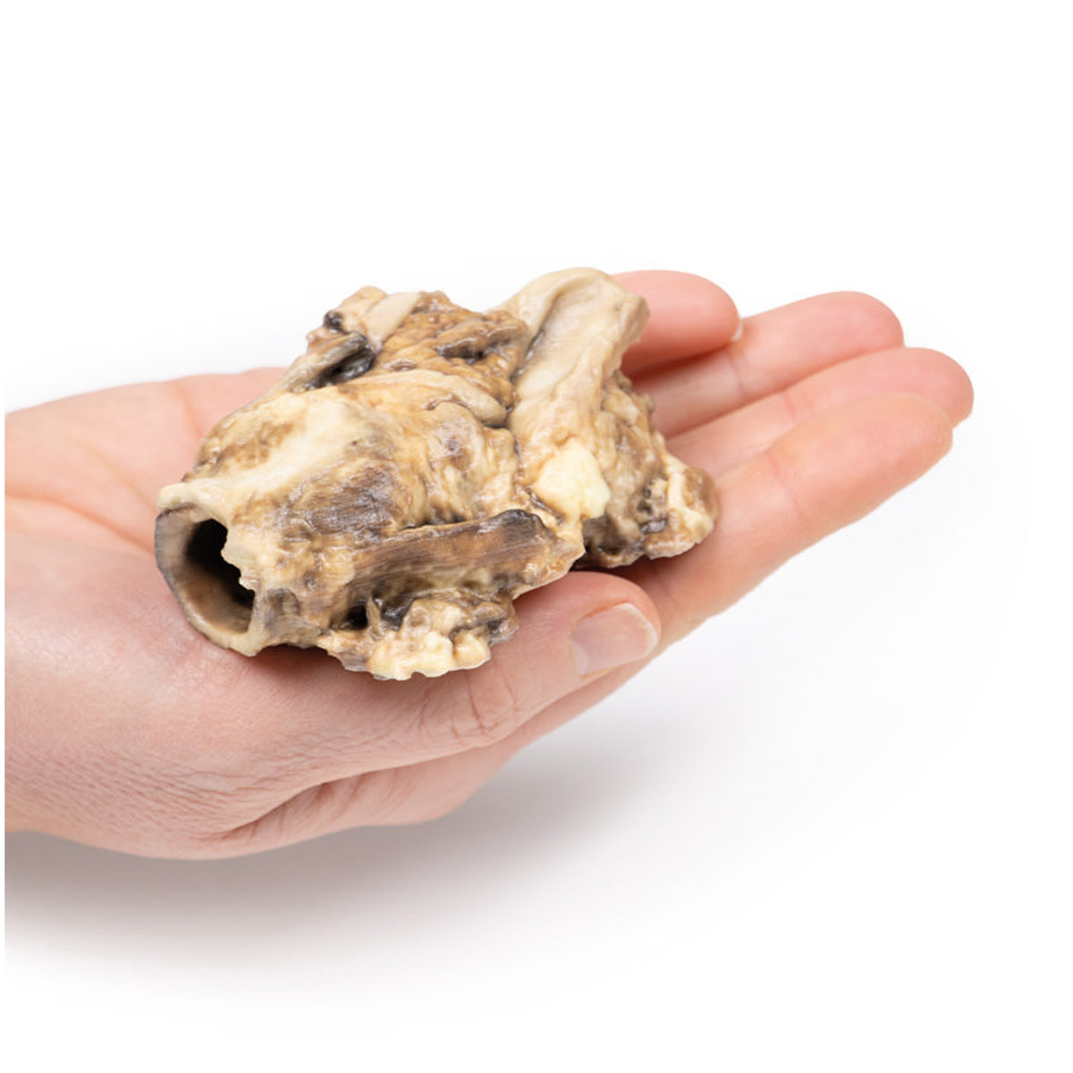 Carcinoma of Pyriform Fossa – Sim & Skills