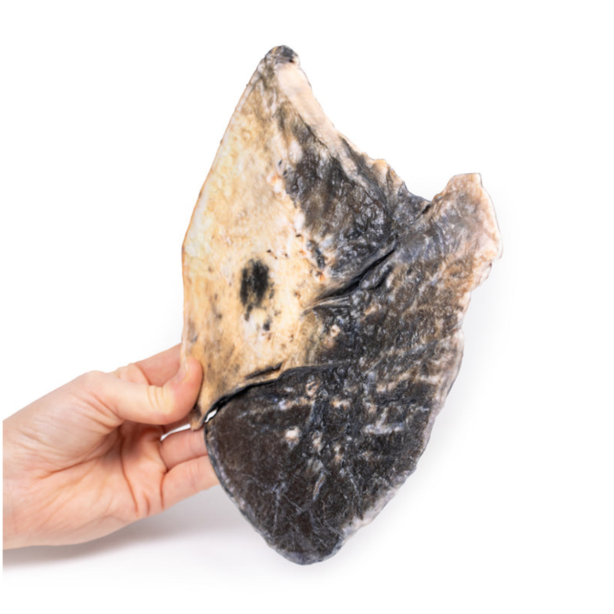 Lobar pneumonia – Sim & Skills