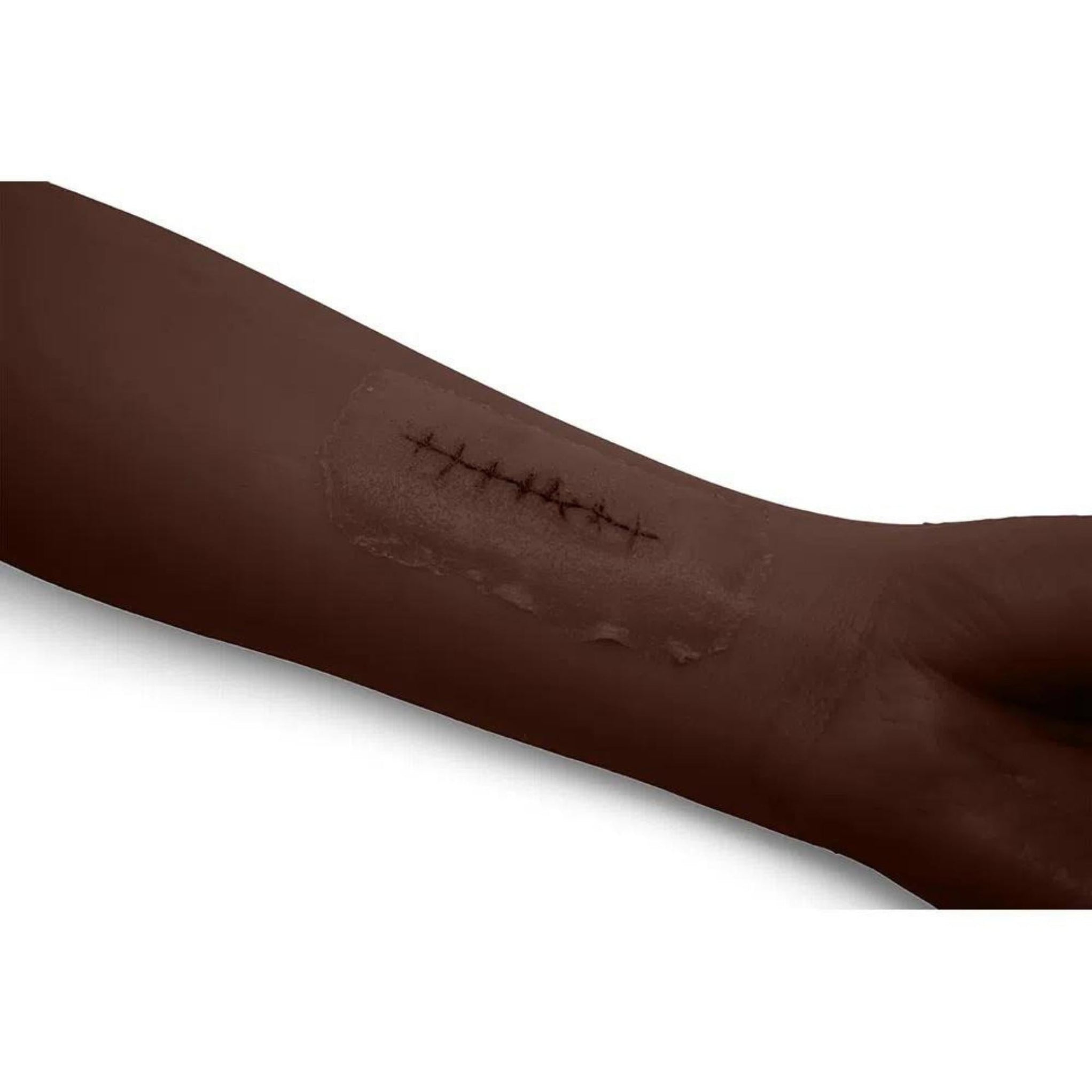 Incision Sticky Wound - Sim & Skills