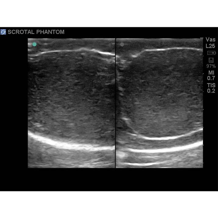 Scrotal Ultrasound Training Model - Sim & Skills
