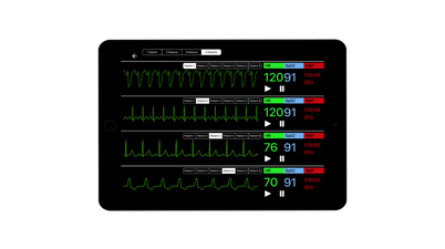SimVS Simulated Patient Monitor Software - Sim & Skills