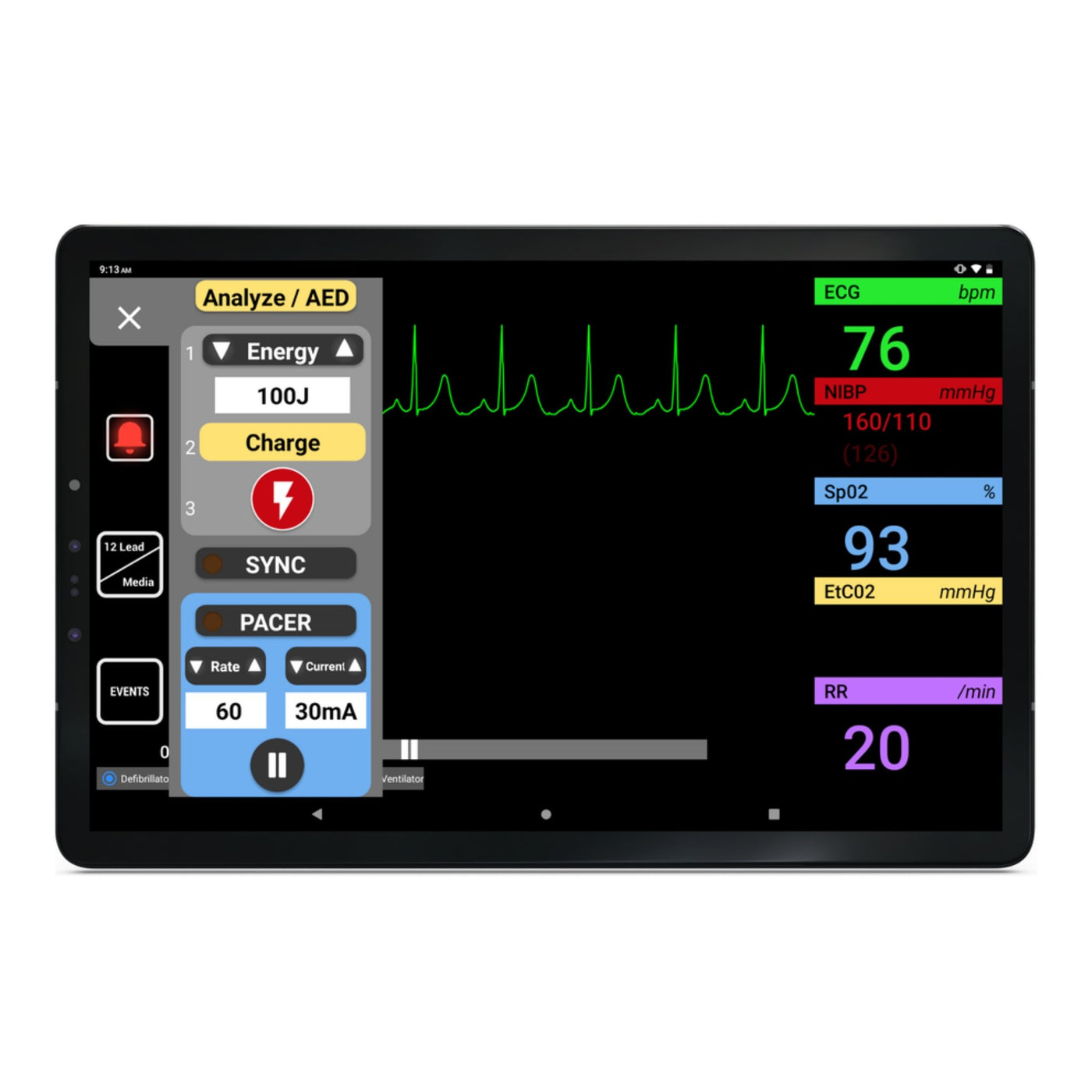 SimVS Simulated Patient Monitor Software - Sim & Skills