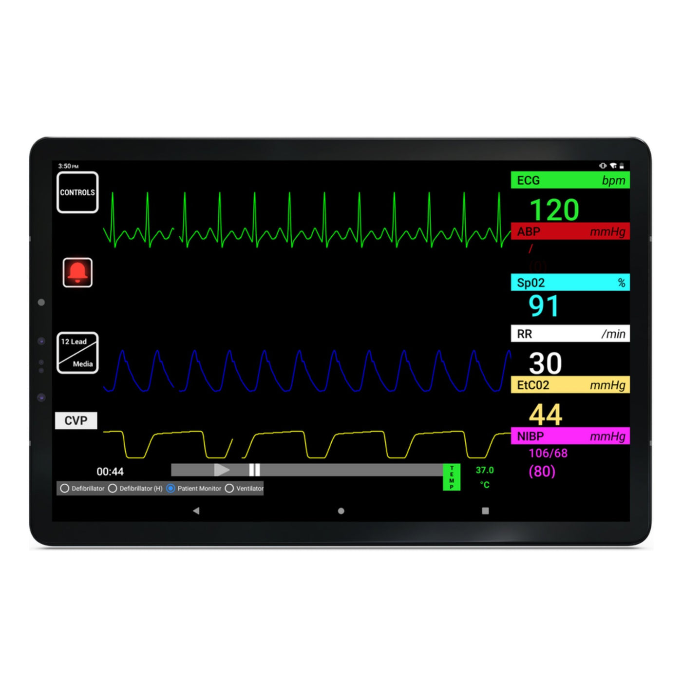 SimVS Simulated Patient Monitor Software - Sim & Skills