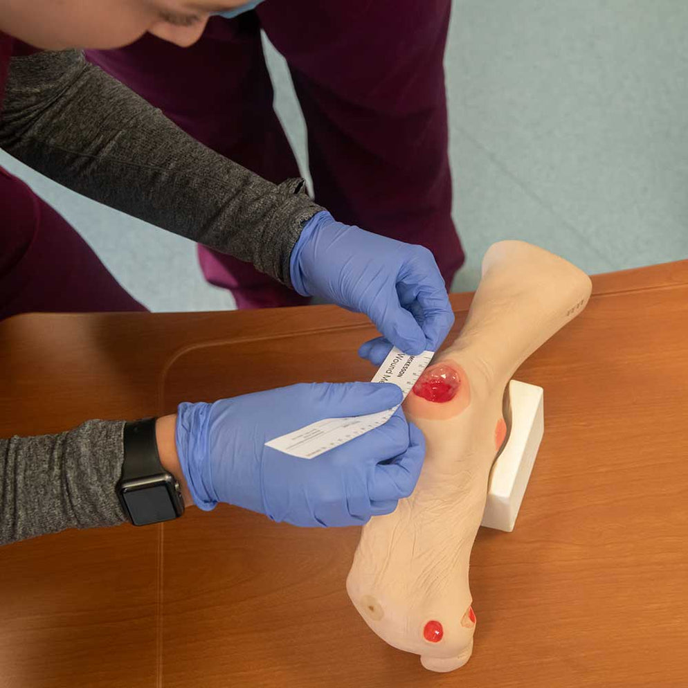 Wilma Wound Foot - Sim & Skills